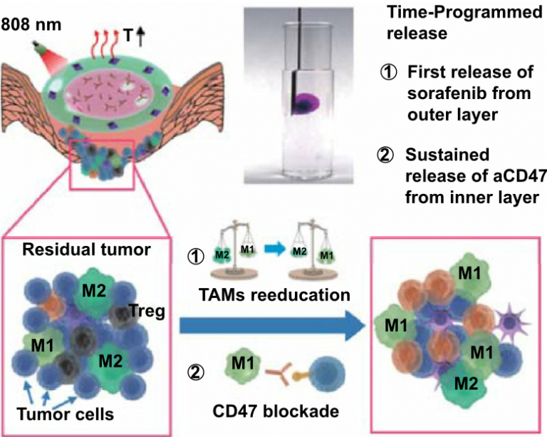 乳腺癌术后治疗：可注射双层凝胶实现索拉非尼和抗CD47抗体的贯序释放-NMSCI.CN
