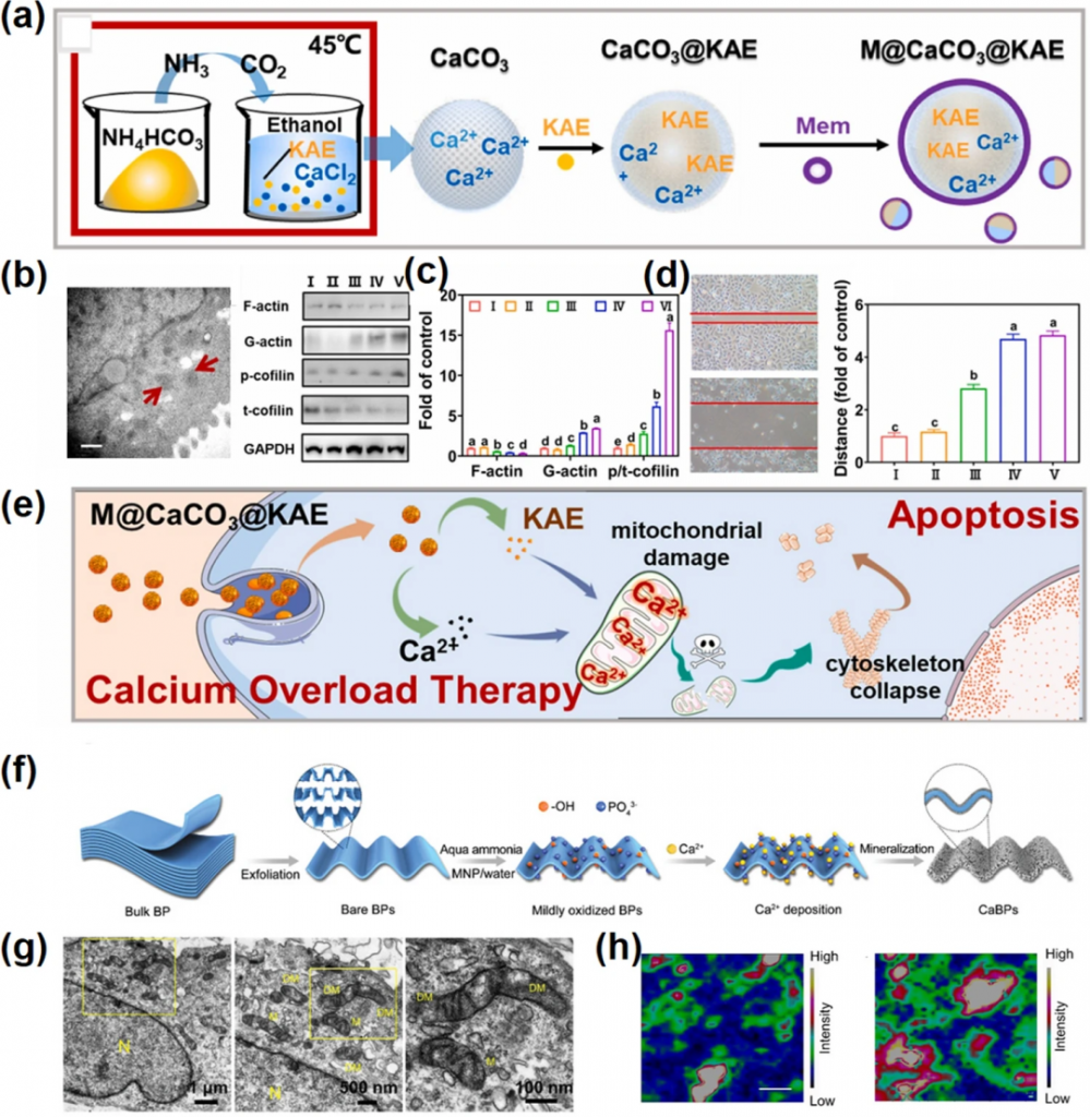 厦门大学刘刚教授团队：钙基纳米材料与癌症—从诊断到治疗-NMSCI.CN