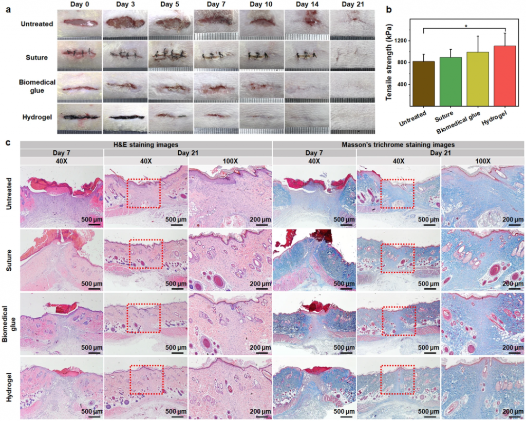 西交大郭保林教授团队：双仿生水凝胶粘合剂用于无创闭合和创面修复-NMSCI.CN